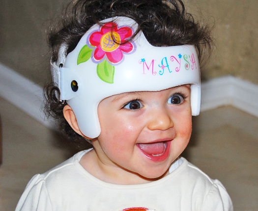 What's Up with The Buells: PLAGIOCEPHALY