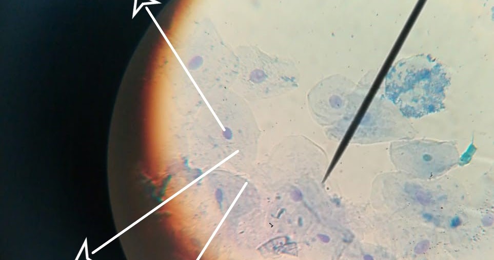 Práctica 1 - "Observación de las células del epitelio bucal"