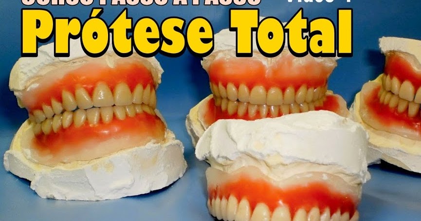 MUFLA EM PRÓTESE TOTAL: Curso passo a passo - Video 4 - Odonto-Tv