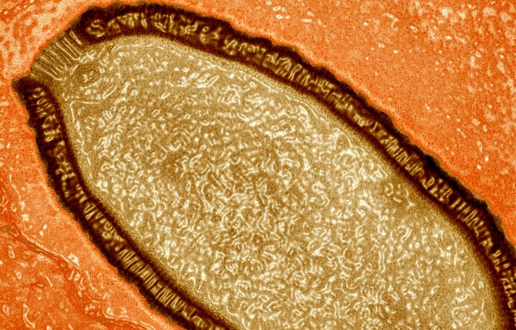 antrophistoria: Un virus gigante ‘revive’ tras pasar 30.000 años congelado.