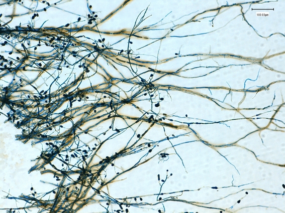 Fun With Microbiology (What's Buggin' You?): Pithomyces species