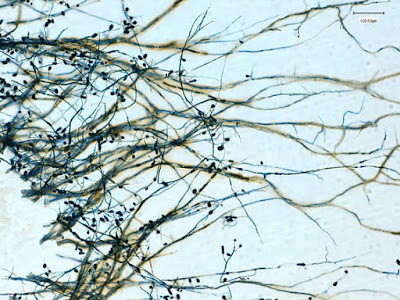 Fun With Microbiology (What's Buggin' You?): Pithomyces species