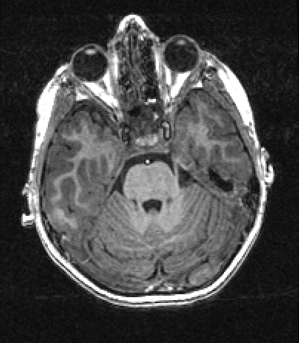 The Playful Spirit: Functional MRI... cool brain mapping!