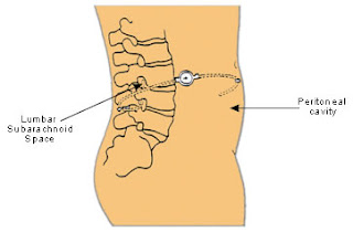 You down with PTC?: Surgery and Other Things