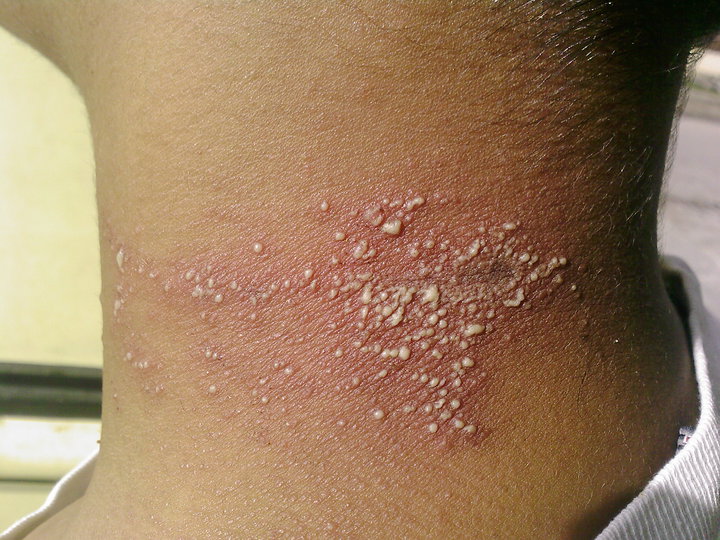 Tomcat dan Cara Mengatasi Serangga Tomcat