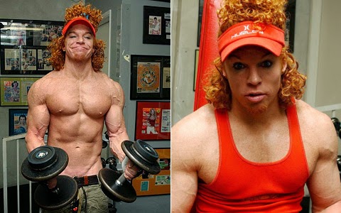 Has Carrot Top Had Plastic Surgery Gone Wrong Before and After Pictures