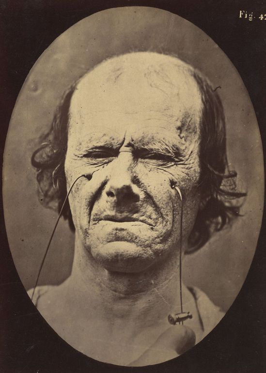 Neuroscience Experiments From the 19th Century: Bizarre and Creepy ...