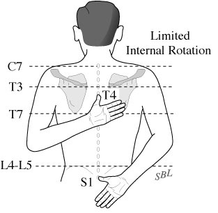 UW Shoulder and Elbow Academy: Rotator Cuff 6 - Clinical examination ...
