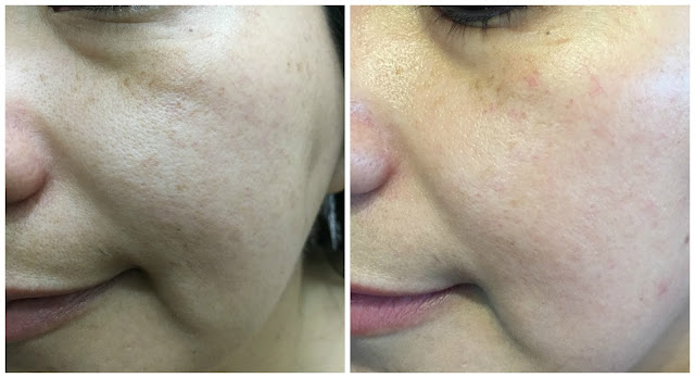 [Skin&Lab] Dr. Bio Infusion Bio Activating Essence | Korean Beauty Dream