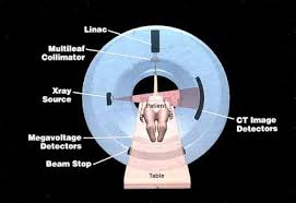 Radiation Therapy Instrumentation: TOMOTHERAPY