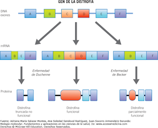 Distrofia Muscular de Duchenne : ¿Qué es la DMD?