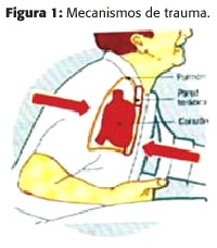 "Marianny Guzman" Semiología Quirurgica: Traumas extra e intra toracicos.