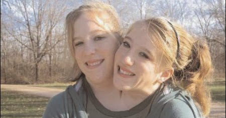 What Is Polycephaly ? - Information Treasure