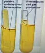 Science matters: Beriberi Eijkman