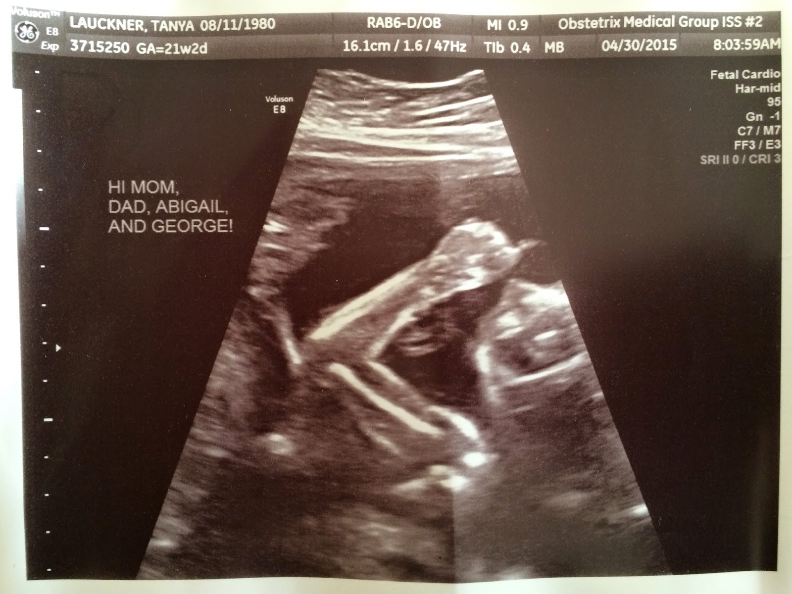 20 week ultrasound