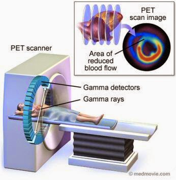 My 29 Lives: Nuclear Heart Scan