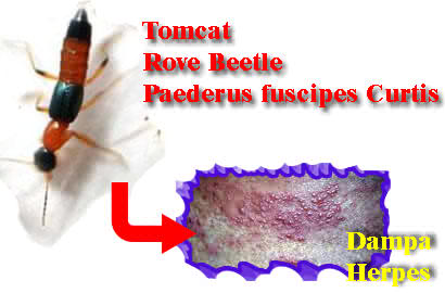 Dunia Sang Maya: Berbahayakah Serangan Dari TomCat.....???