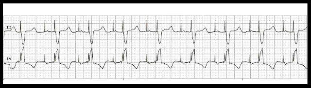 Practice EKG Strips