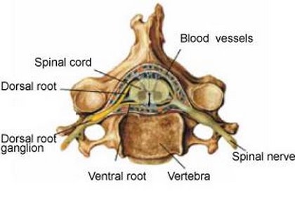 Whiplash associated disorder
