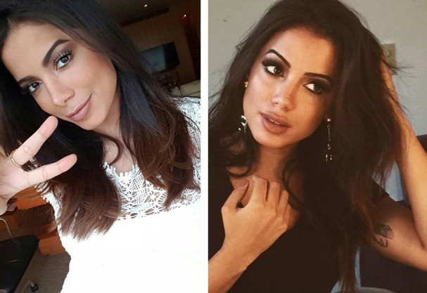 Anita Antes E Depois Da Plastica