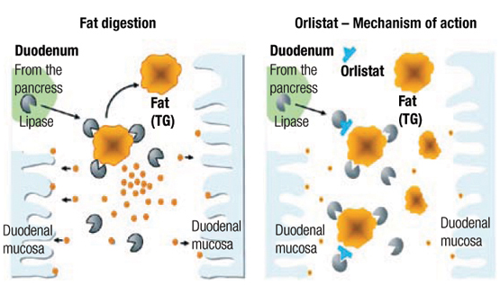 KedaiOnlineSelamat: Orlistat 120mg Cuvarlic Aslene