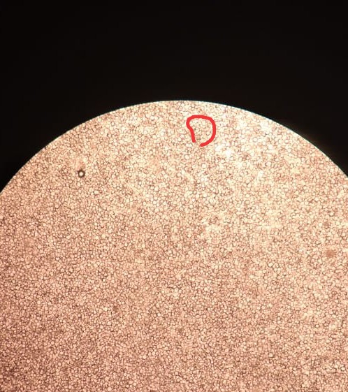 BENDA ERGASTIK ALEURON PADA TUMBUHAN