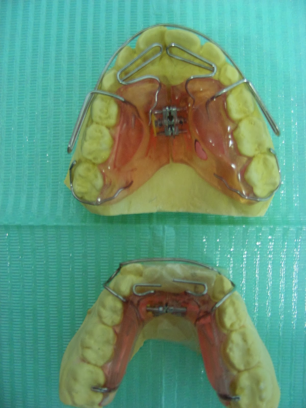 Ortopedia funcional dos maxilares: Janeiro 2014