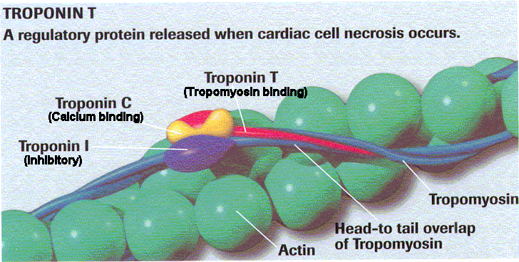 Clinician On Net: Recapitulate the Role of Troponin in Cardiac Muscle ...