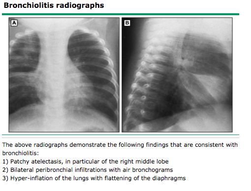 RED LATINOAMERICANA DE PEDIATRÍA Y NEONATOLOGÍA: [UPTODATE ...