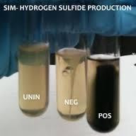 Hydrogen Sulfide (H2S) Production Test - Microbiology Lab Notes