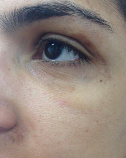 Ana Cristina Diniz - Dermatologia Estética - Cosmetic Dermatology ...