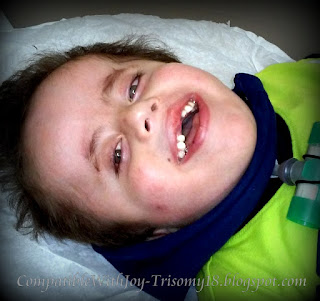 Compatible With Joy-Trisomy18: 11/01/2015 - 12/01/2015