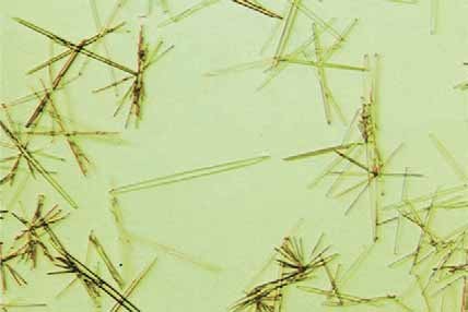 [Haematology] Microscopic Examination of Urinary Sediment - Crystals ...