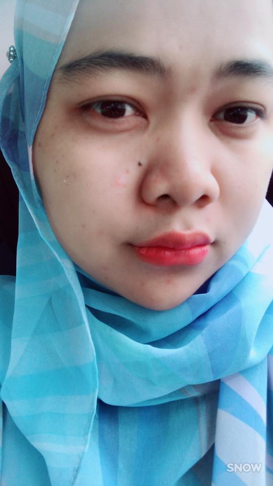 ~~aku insan biasa~~: NAK MUKA PUTIH MERAH JAMBU