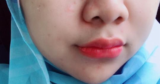 ~~aku insan biasa~~: NAK MUKA PUTIH MERAH JAMBU