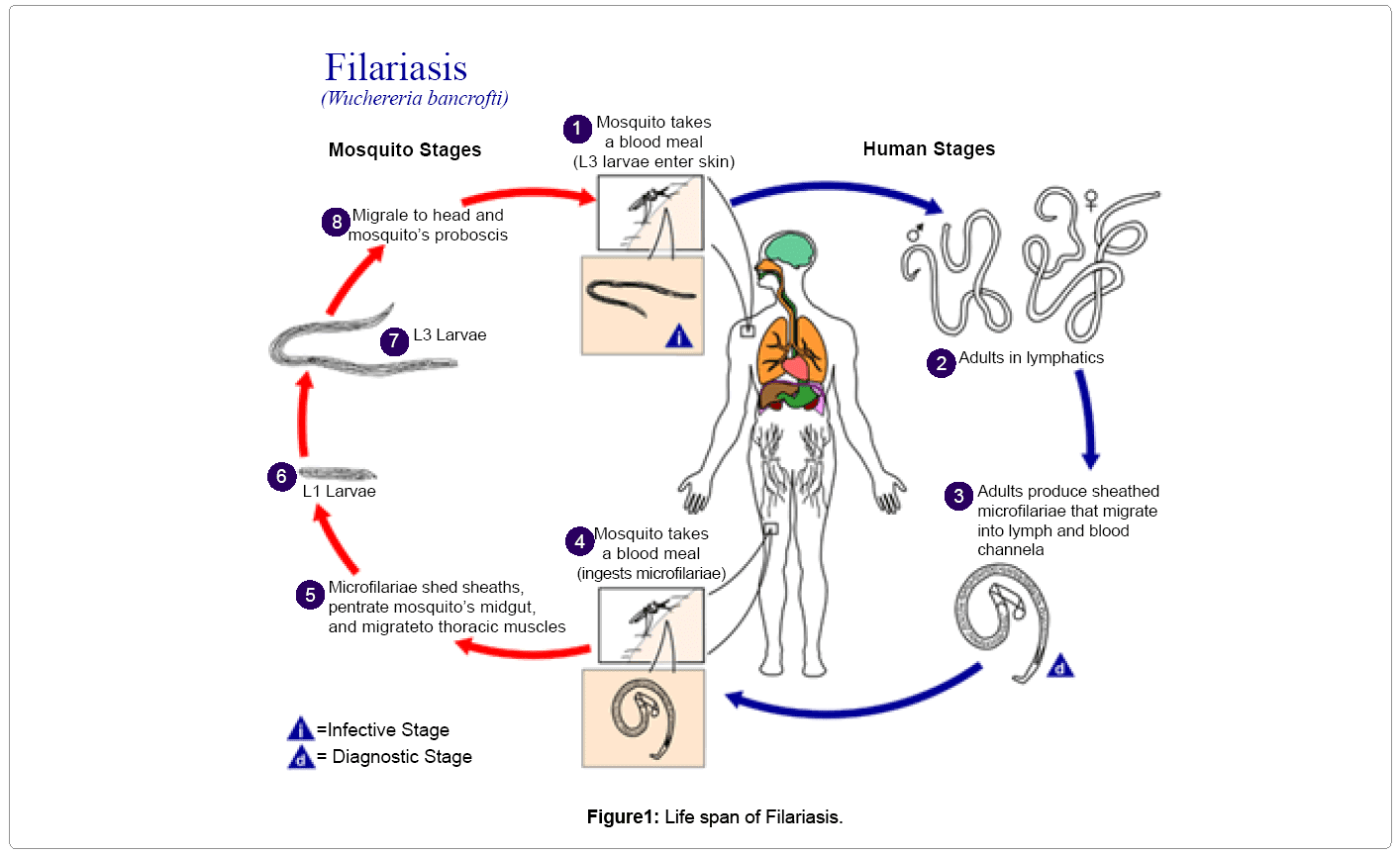 Mal Sithroo: පණු රෝග - 04 බරවා රෝගය /Filariasis