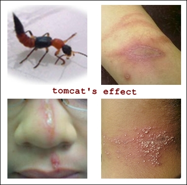 Cara Mengatasi dan Mencegah Gigitan Serangga Tomcat - Ari Software ...