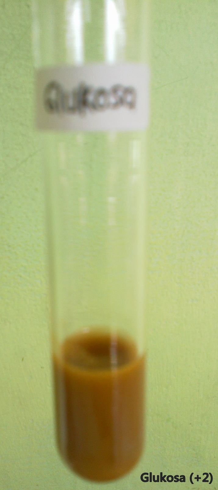 Pemeriksaan Urinalisis Lengkap | Analis Kesehatan