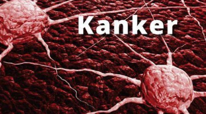 Inilah Tanda dan Gejala Kanker, Anda Punya Kanker? - Pasien Sehat