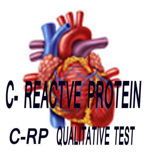 mltshiksha.blogspot.com: C-Reactive Protein (Qualitative test of C-RP)