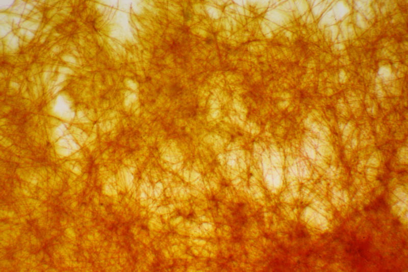 El mundo microscópico de los hongos: Pisolithus arhizus (Scop.per Pers ...