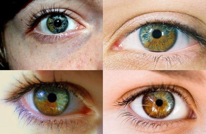 De tudo um pouco 7ºB : Heterocromia. O que é isso?