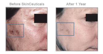 Nuala Woulfe Beauty: Why does our Skin Age