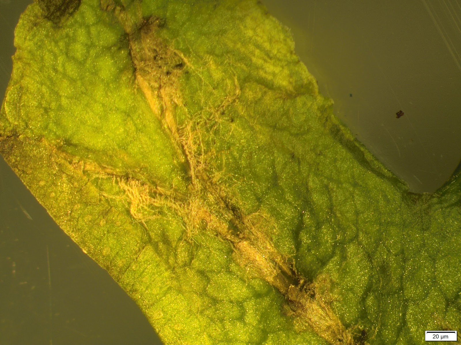 Herbarium Collection: Liverworts