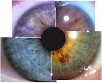 Maria Líria: Iridologia - O que a nossa iris revela