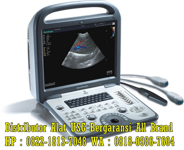 Science Archive: Alat USG yang bagus untuk pemeriksaan ANC dan abdomen