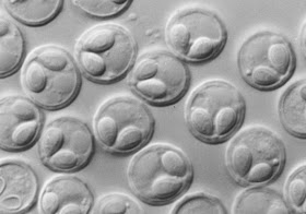 Real Monstrosities: Myxozoa