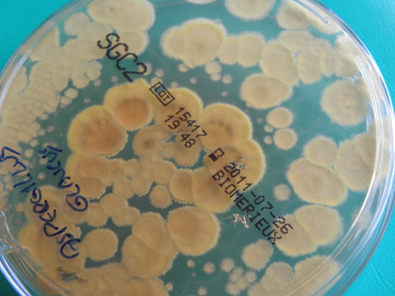 ATLAS MICOLOGIA: ASPERGILLUS GLAUCUS