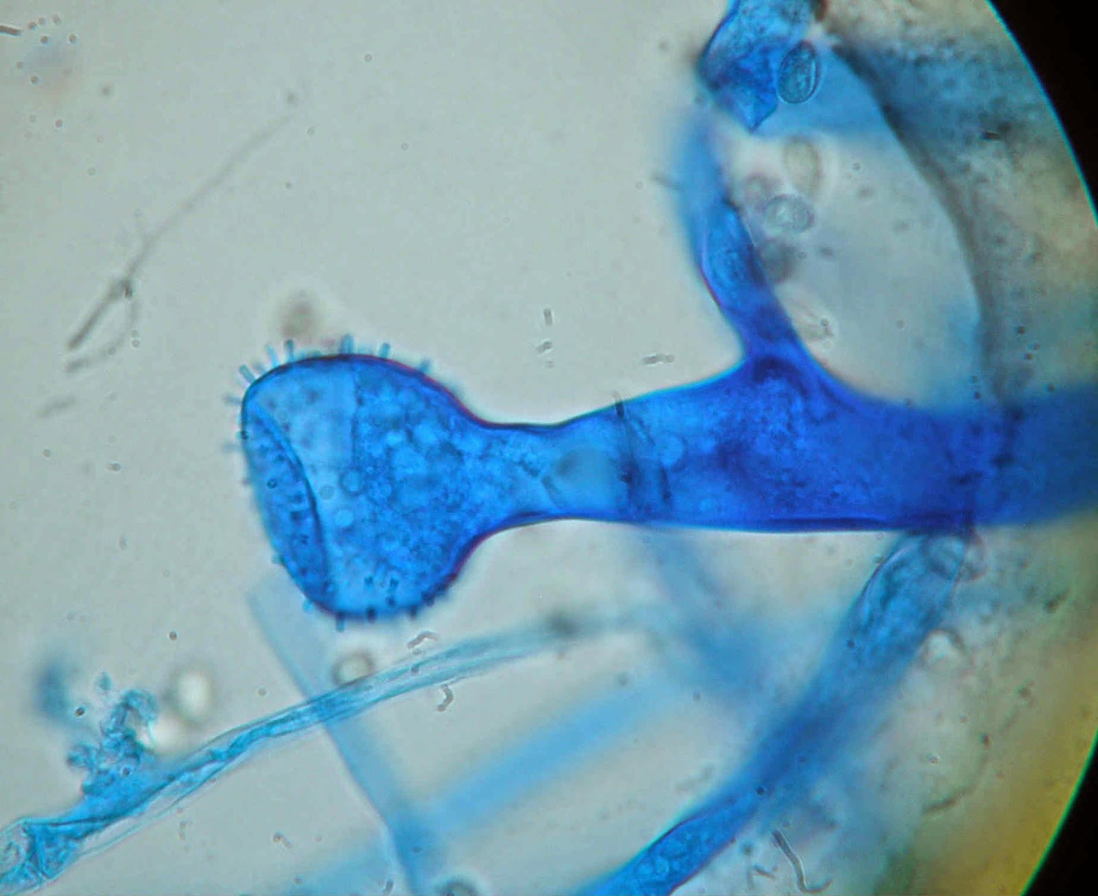 ATLAS MICOLOGIA: CUNNINGHAMELLA BERTHOLLETIAE