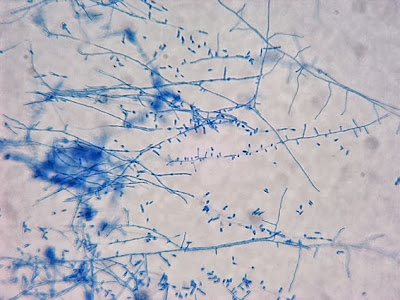 Fun With Microbiology (What's Buggin' You?): Trichophyton terrestre